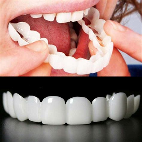 Renyqatt Tooth Repair Kit Moldable False Teeth Diy Dental