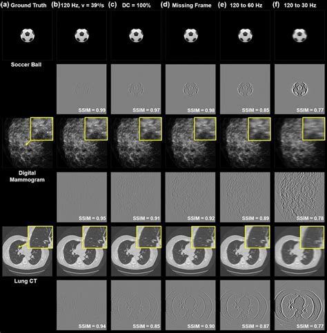 Visualizations Of Motion Image Artifacts And Motion Image Errors