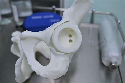 私人定制”髋关节——当医学遇见3d打印 新重庆客户端