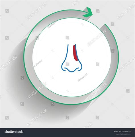 Nasal Polypectomy Surgery Removing Polyps Clearer Stock Vector Royalty Free 2507855129