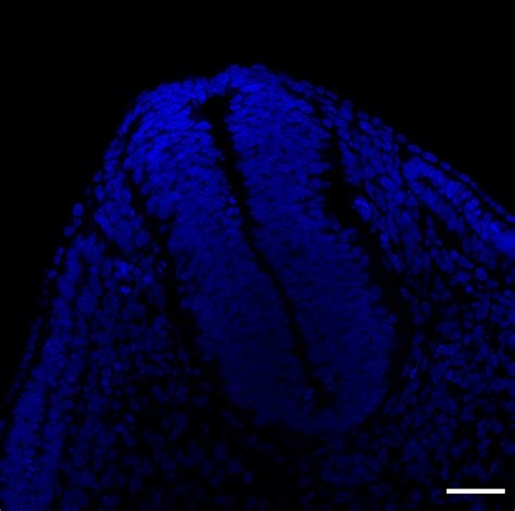 Cs13 And Cs18 Rnascope