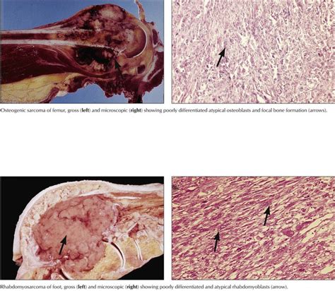 General Reaction Patterns Basicmedical Key
