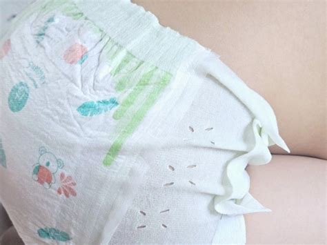 기저귀발진크림 신생아엉덩이발진 보습 중요해요 네이버 블로그