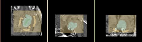modules growcutsegmentation documentation 3 6 slicer wiki