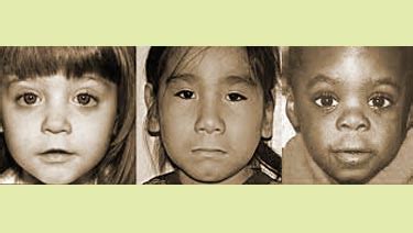 Fetal Alcohol Spectrum Disorders