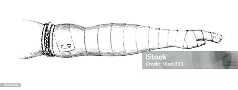 A Eulenburg에 의해 의료 과학의 오래된 책 백과 사전에 붕대 손 Vol 7 S 피터스 버그 1895 건강관리와 의술에 대한 스톡 벡터 아트 및 기타 이미지 Istock