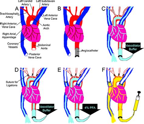 Retrograde Perfusion And Filling Of Mouse Coronary Vasculature As