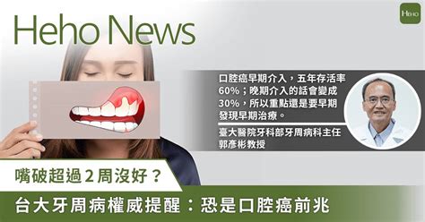 【heho News】嘴破超過2週沒好？台大牙周病權威提醒：出現口腔癌「四大前兆」建議就醫 Heho健康 Line Today