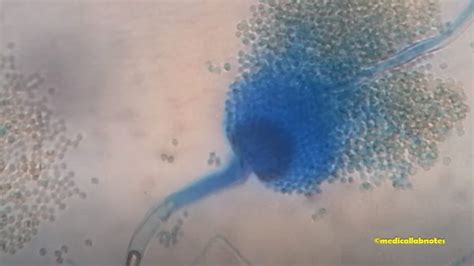 Lactophenol Cotton Blue Lpcb Stain Introduction Principle Test