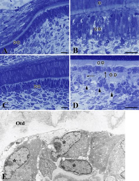Light And Electron Micrographs Showing Differentiating Odontoblasts And