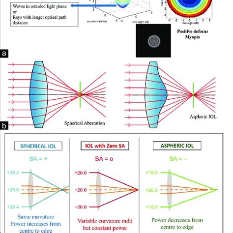 A Lower Order Aberration Defocusmyopia B Formation Of Spherical Download Scientific