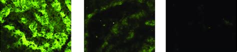 The Results Of Fluorescent Staining Evaluation With Fluorescence