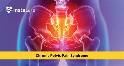 What You Must Understand About Chronic Pelvic Pain Syndrome