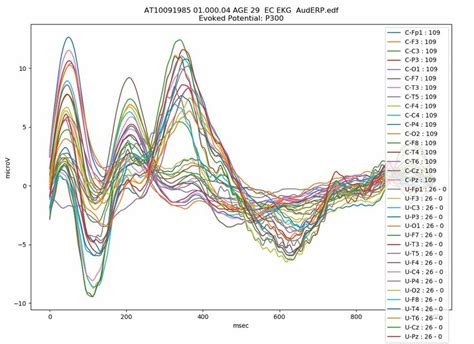 Pdf Event Related Potential P300