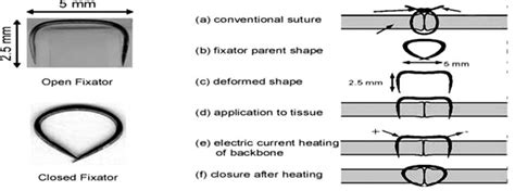 Variable Curvature Devices For Laparoscopic Surgery A Dissecting Download Scientific Diagram