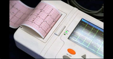 Dr Haresh Mehta On Linkedin Artificial Intelligence Algorithm Predicts Survival After Heart Surgery