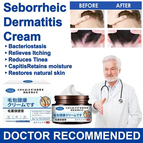 【buy 2 Get 1 Free】seborrheic Dermatitis Cream Scalp Treatment Psoriasis