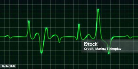 심장 박동 펄스 모니터 녹색 전파 신호 오실로스코프 그래프 빛 빛 효과심 전경 선 그래프 기술 V벡터 일러스트레이션 녹색에 대한