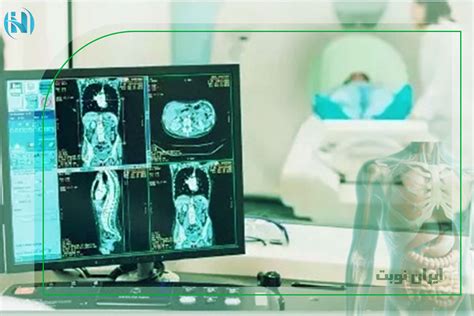 ام آر آی شکم و لگن با تزریق و آنچه بیماران باید بدانند