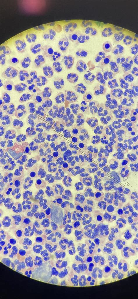 What In The World Are These Mononuclear Cells With Pink Granules My Boss Said Pyknotic Cells