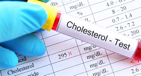 Cholesterol Test Understanding Your Blood Test Results Dr Sandra Cabot MD