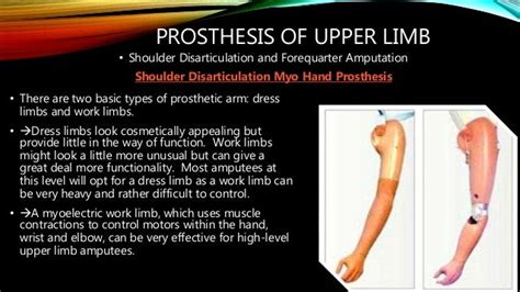 Forequarter Amputation Amputation Of Forequarter Trlp