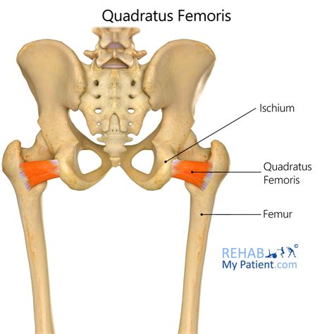 Quadratus Femoris Trigger Point Frontiers Advancing Musculoskeletal