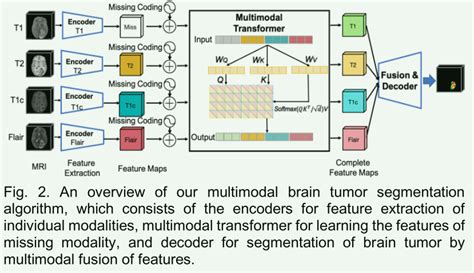 【论文阅读笔记】multimodal Transformer Of Incomplete Mri Data For Brain Tumor