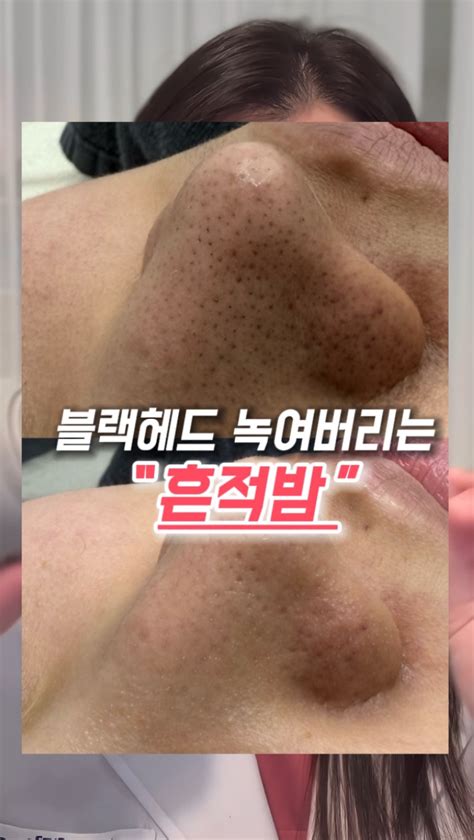 연뷰티대표 김희연 광주피부관리 파메스테틱 1인샵 억대연봉마스터 영상속에 나오는 저만의 꿀팁으로 에스테틱이나 피부과에 가지않아도 블랙헤드요철 흉터하나없는 백옥
