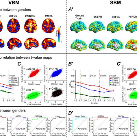 Gender Difference Of Brain Morphometry Based On Different Sr Download Scientific Diagram