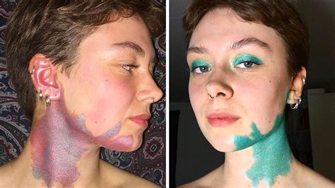 Cute Birthmark