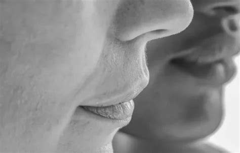 Your Guide To Treating Upper Lip Melasma Kaia Naturals