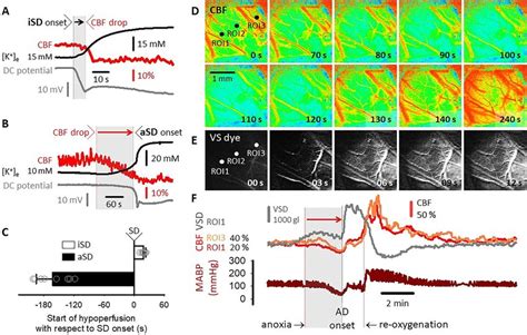 The Temporal Sequence And The Latency Between Spreading Depolarization Download Scientific