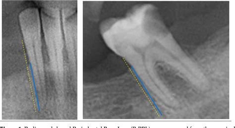 Figure 1 From Analyzing Oral Health Conditions In Sex Workers—a Comparative Retrospective