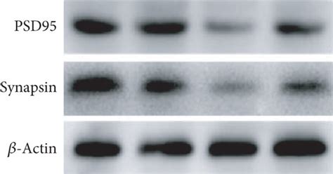 Celastrol Upregulated Neurexin 1β Neuroligin 1 Psd95 And Synapsin Download Scientific