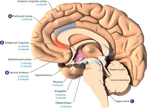 Major Depression Brain