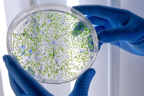 Infections à Staphylococcus Aureus Meilleures Cliniques ️