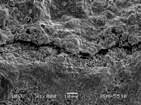 Marginal Adaptation Of Mta Sem ×1000 Magnification Download Scientific Diagram