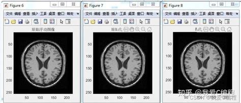 基于互信息和归一化互信息的医学图像配准算法matlab仿真 知乎