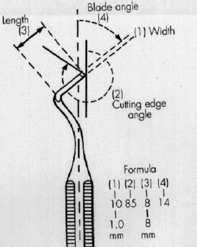 Week 6 Preparation And Restoration For Class Ii Lesions With Amalgam 🪐 Flashcards Quizlet