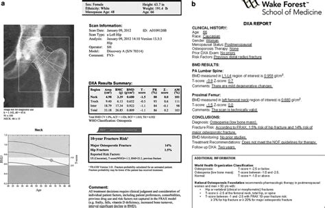 Frax Score Singapore