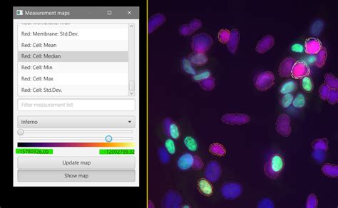 Error In Measurement With Stardist Script With Rgb Fluorescence Images