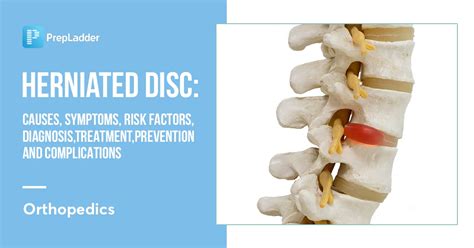 Navigating The Workplace With Disc Protrusion Symptoms