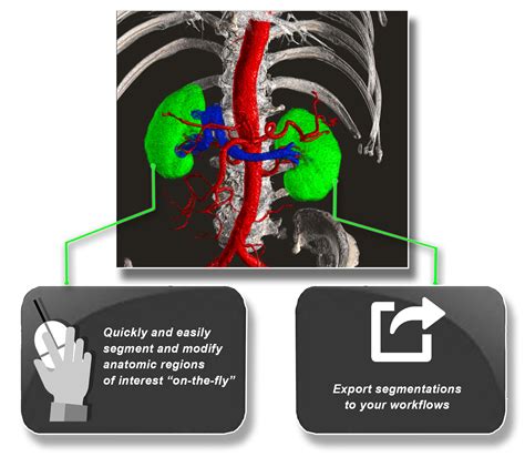 Interactive Segmentation For Oems In Radiology Via Imaging Sdks