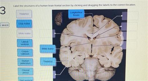 Solved Label The Structures Of A Human Brain Frontal Section