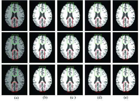 The Results Of Brain Mr Image Segmentation With 3 7 9 Noise A