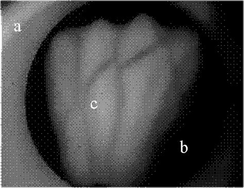 Non Contact Self Adapting Extraction Method For Roi Region Of Interest Of Fist Clenching Type