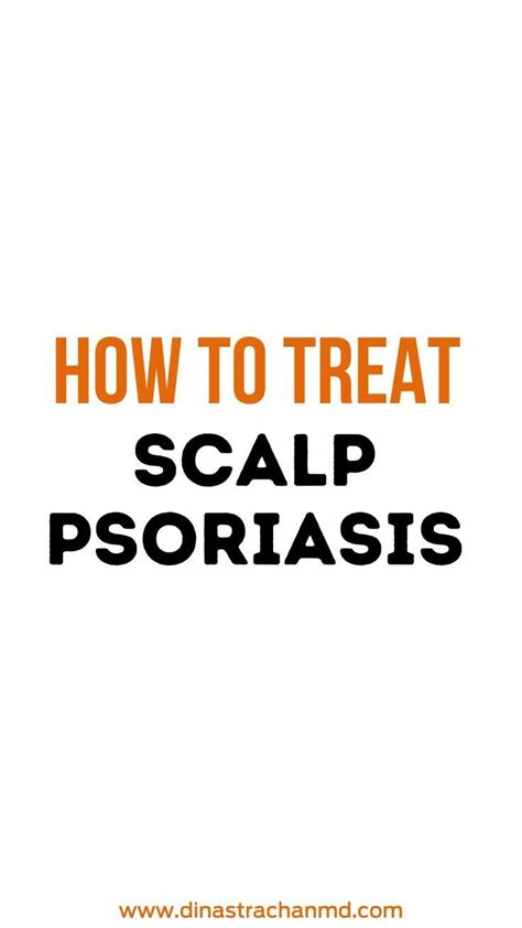 Best 13 7 Tips For Treating Scalp Psoriasis Naturally Artofit