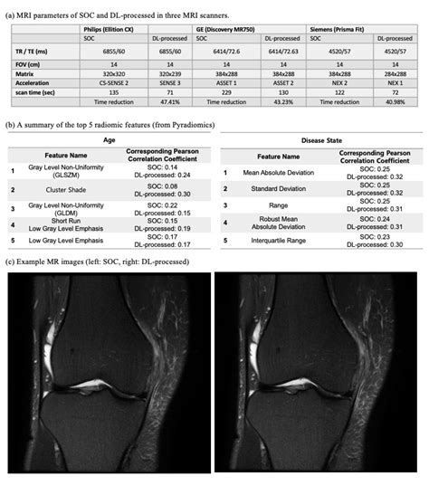 Enhancing Radiomic Feature Correlations And Reproducibility In Knee Mri