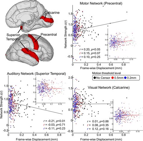 Motion Is Related To Fc Strength In Motor And Auditory Areas Left Download Scientific Diagram